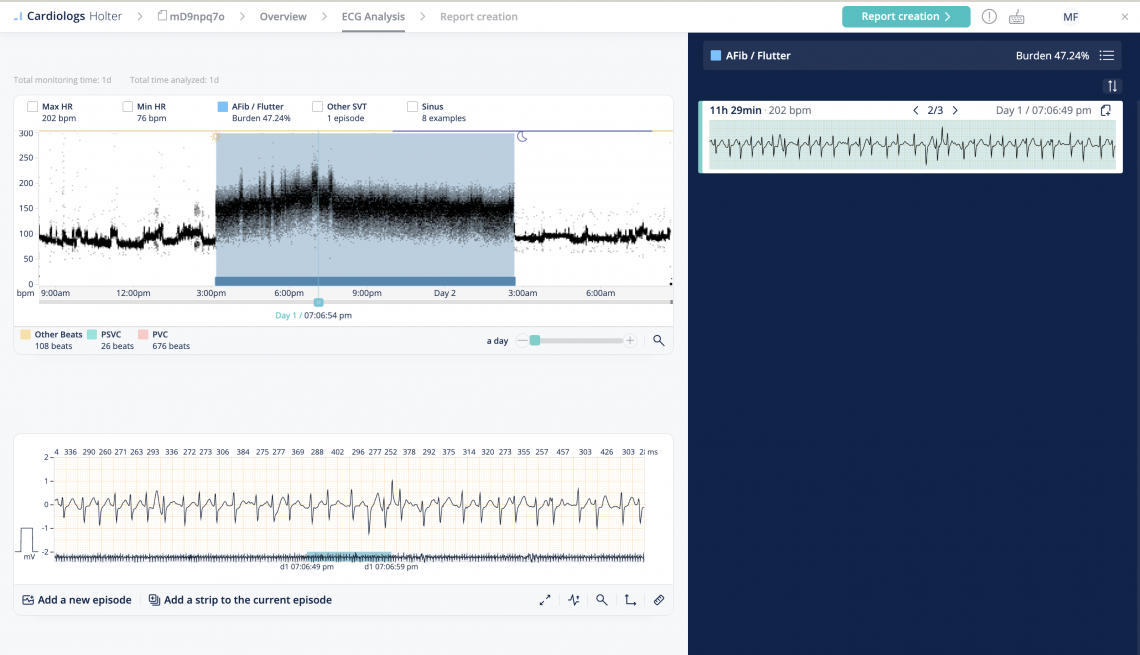 MyTicker - TickerCardiology